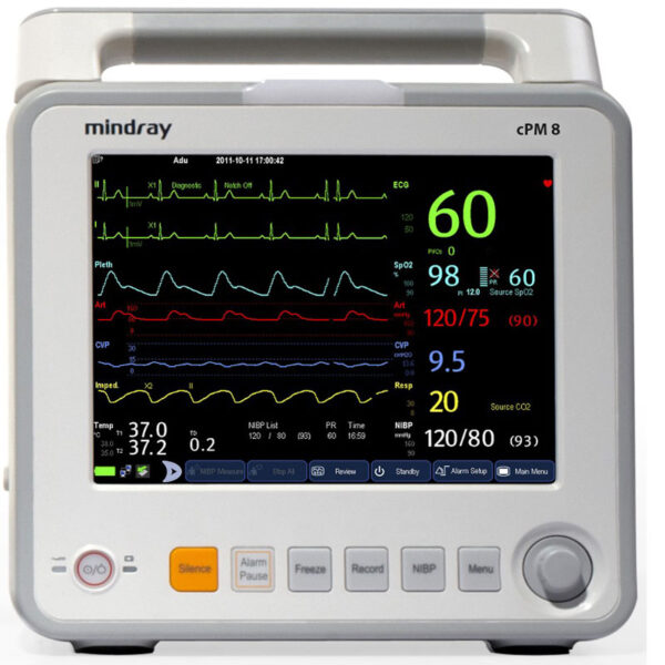 Mindray cPM Series 8/12 Patient Monitor - Overstockme.com